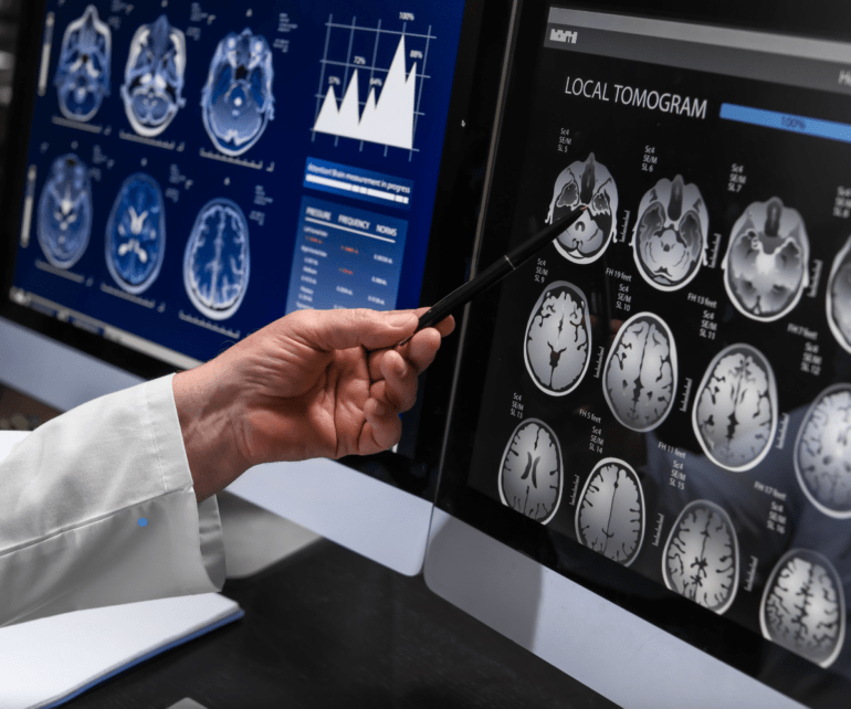 Advanced Heart Imaging - Ayushman Heart Care Center