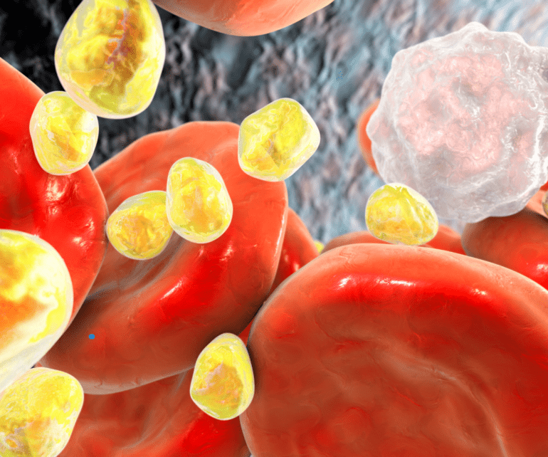 Lipid Management - Ayushman Heart Care Center